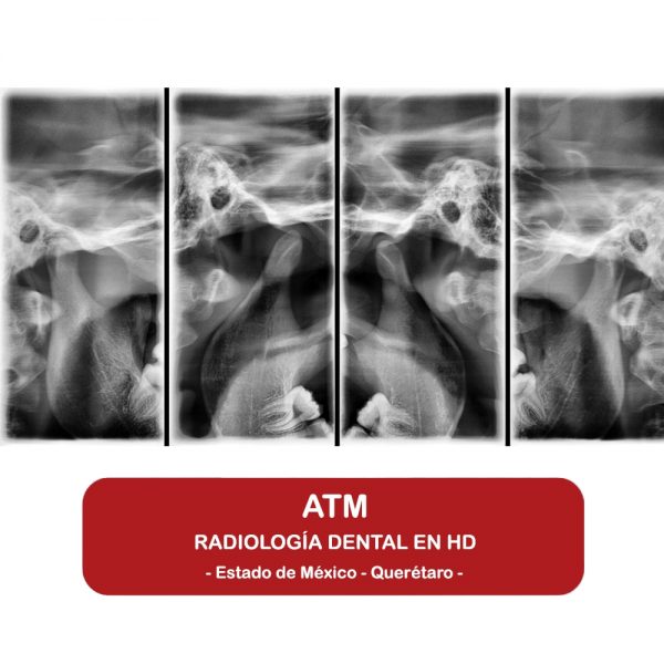 ATM – Orthodiagnóstico