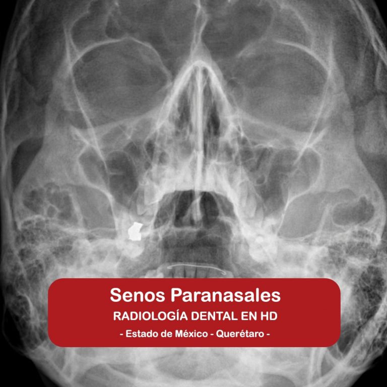 Radiologia Dental en HD – Orthodiagnóstico